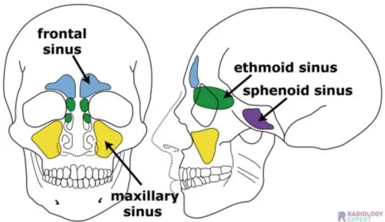 Ct Paranasal Sinus Pns With Contrast Askradiographerdotcom