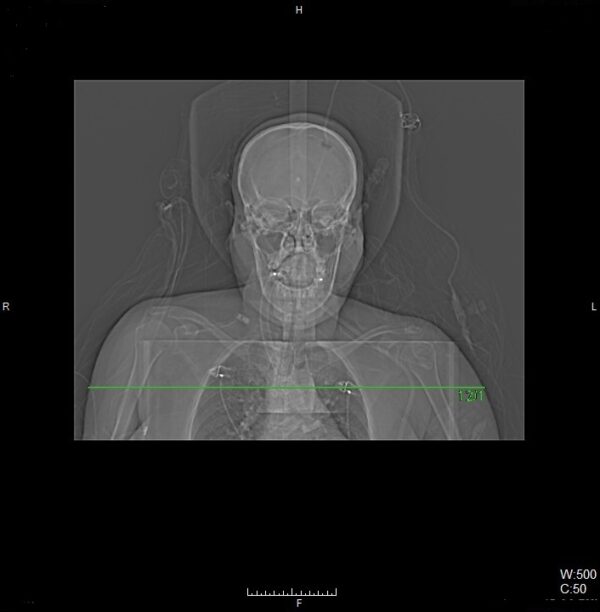 CTA BRAIN - AskRadiographerDotCom