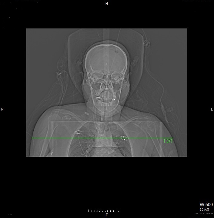 CTA BRAIN - AskRadiographerDotCom
