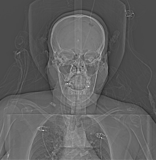 CTA BRAIN - AskRadiographerDotCom