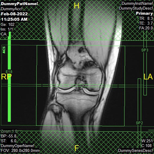 MRI RIGHT KNEE - AskRadiographerDotCom
