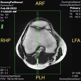 MRI RIGHT KNEE - AskRadiographerDotCom