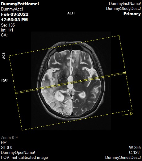 MRA & MRV OF BRAIN - AskRadiographerDotCom