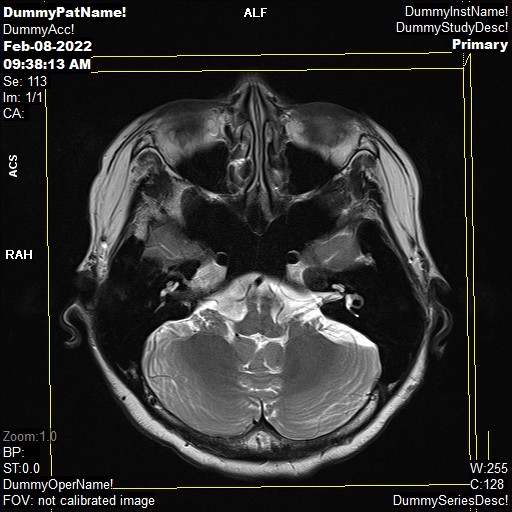 MRI IAM - AskRadiographerDotCom