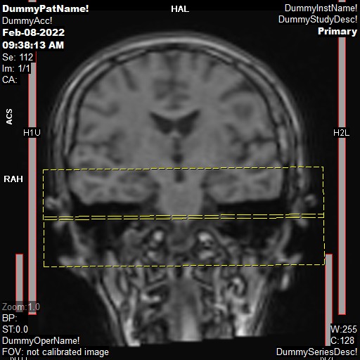 MRI IAM - AskRadiographerDotCom