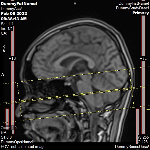 MRI IAM - AskRadiographerDotCom