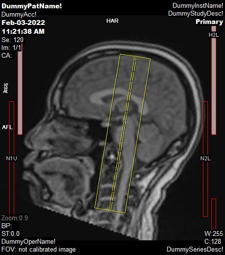 MRI IAM - AskRadiographerDotCom