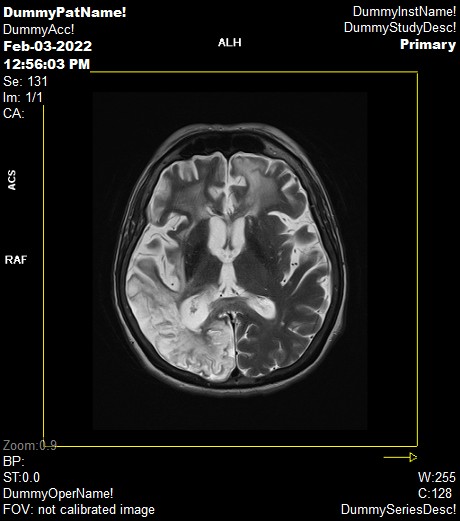 MRI IAM - AskRadiographerDotCom
