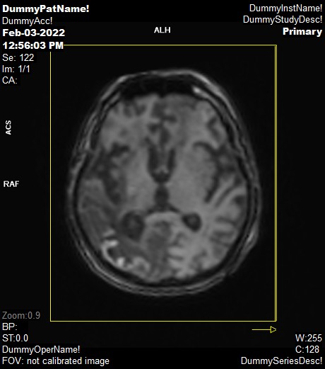 MRI IAM - AskRadiographerDotCom