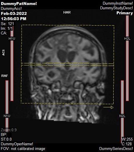 MRI IAM - AskRadiographerDotCom