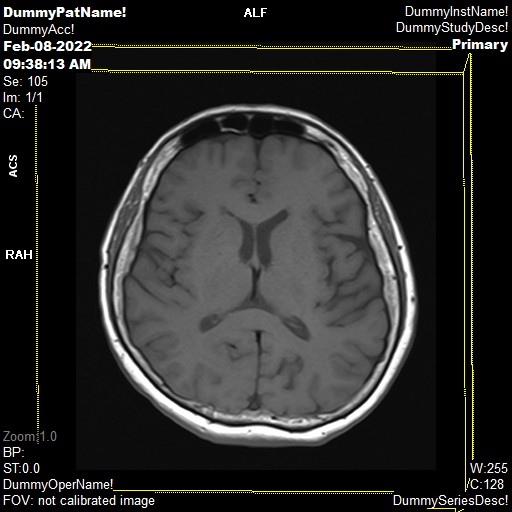 MRI IAM - AskRadiographerDotCom