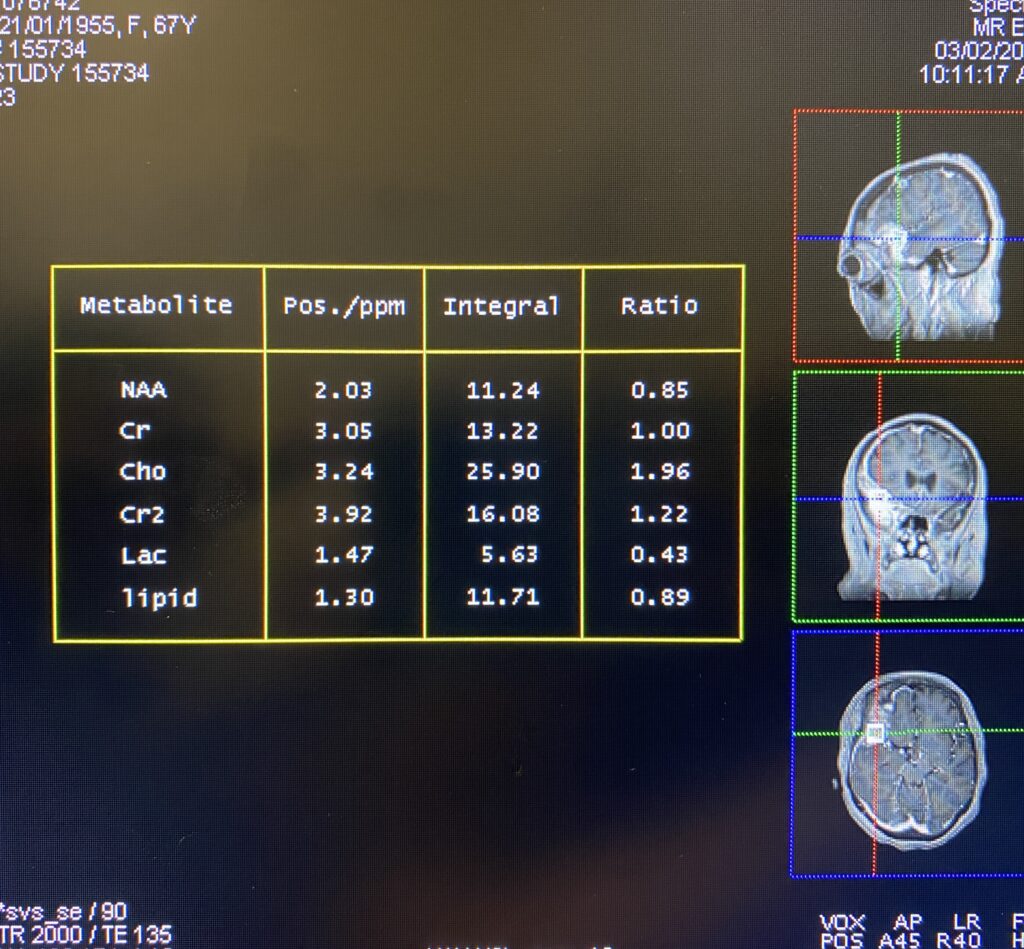 MRI SPECTROSCOPY - AskRadiographerDotCom