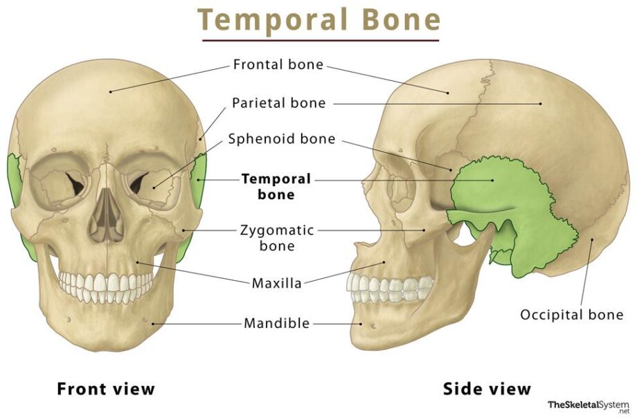CT TEMPORAL BONE WITH CONTRAST - AskRadiographerDotCom