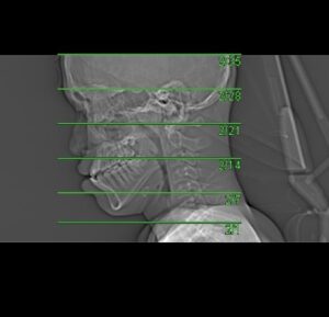 CT FACIAL WITH CONTRAST - AskRadiographerDotCom